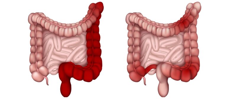 Ανατομία του παχέος εντέρου